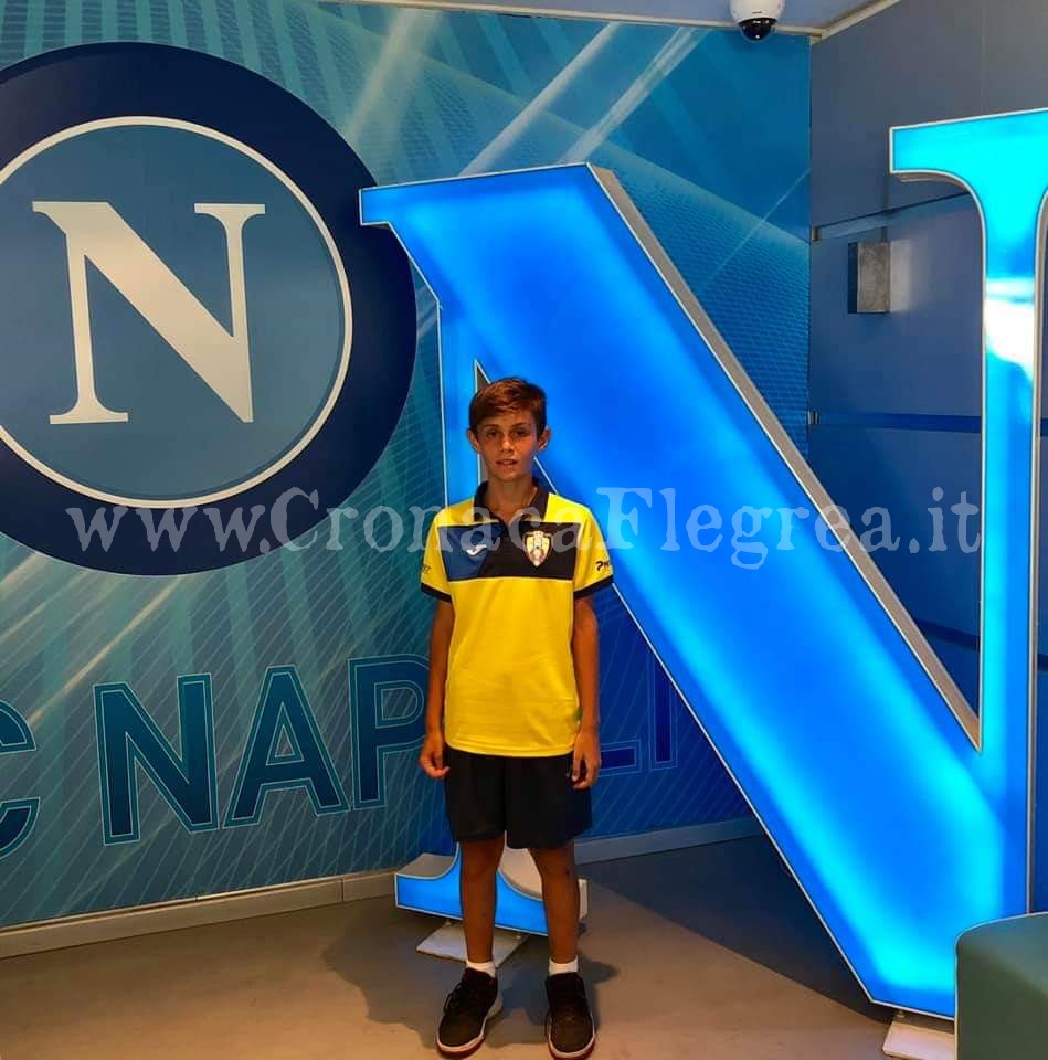 Chiocca bimbo napoli – Cronaca Flegrea